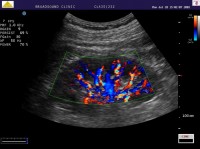 about us - Broadsound Corporation